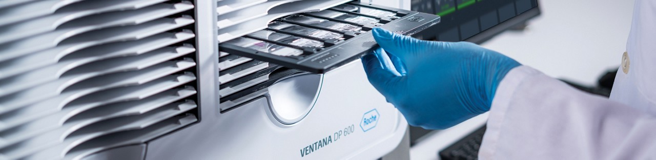 2025: The future of cancer diagnostics in the pathology lab